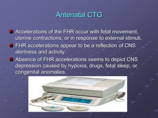 Copy of ANTENATAL FETAL MONITORING-Hatem.ppt