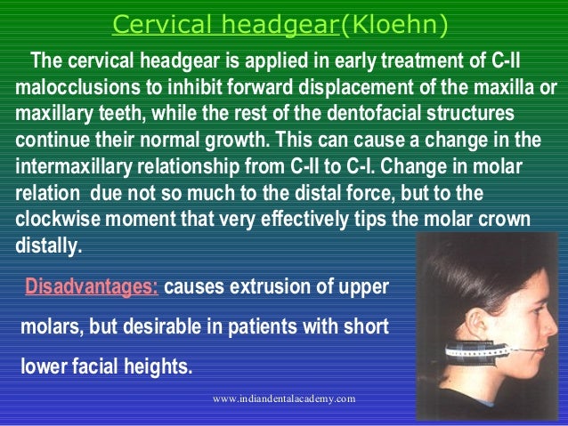 Copy of biomech of head gear /certified fixed orthodontic courses by