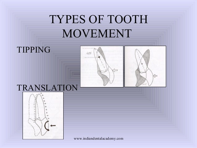 Copy of biomech of tooth movemnt