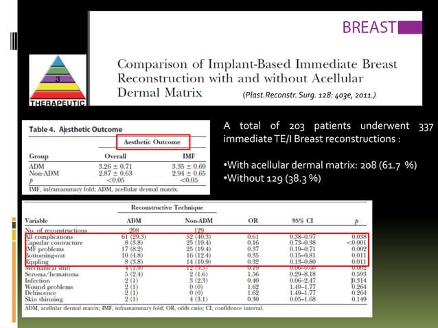 Implant-Based Breast Reconstruction | PPTX