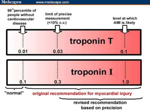 cardiac troponin assay utility in early detection of acute coronary ...