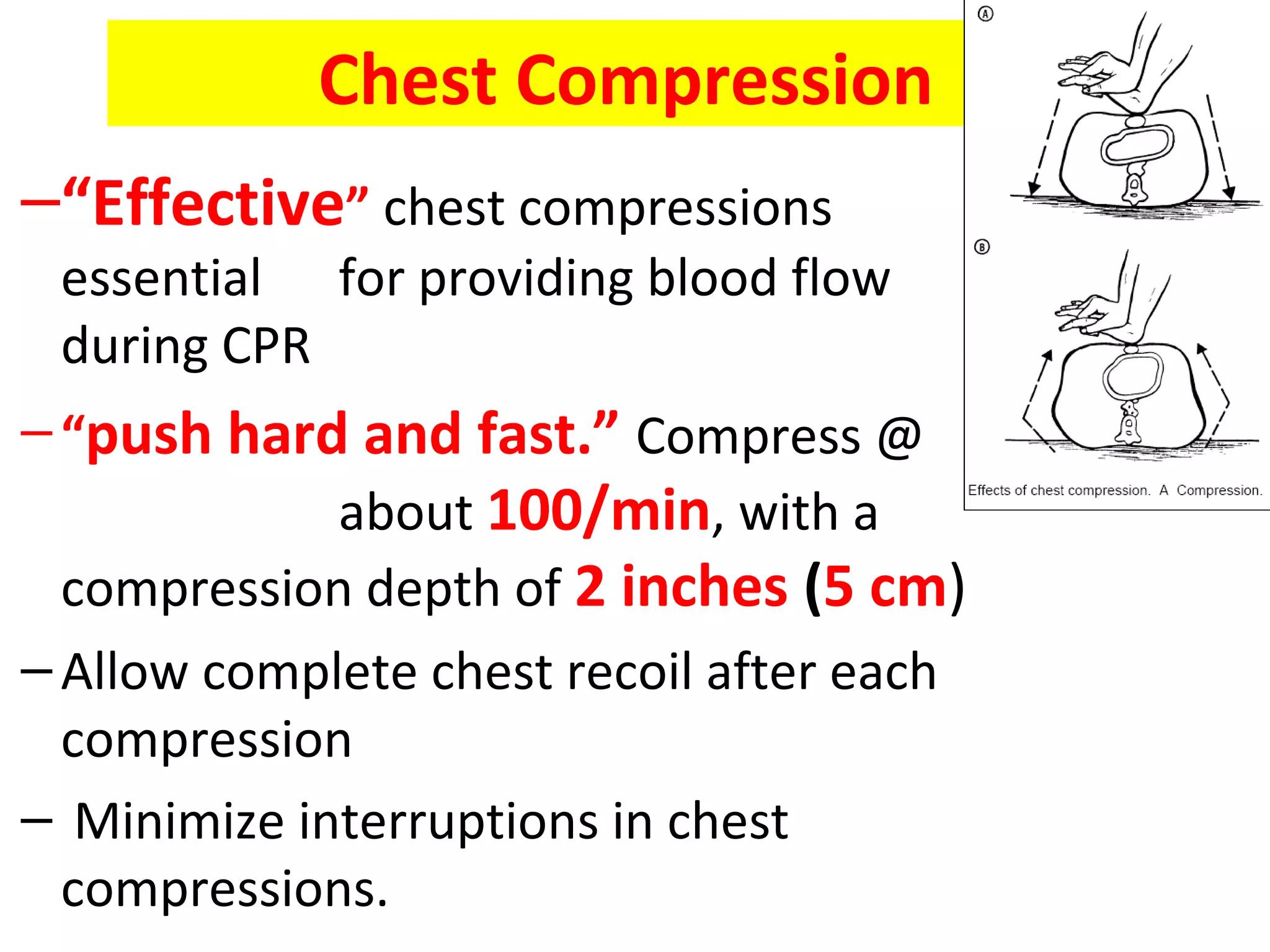 cardiopulmonary resuscitation for students | PPT