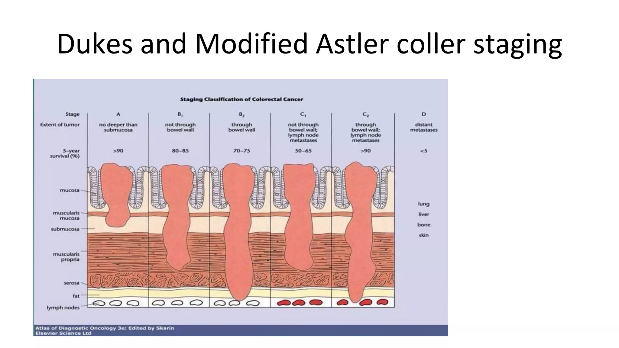 Carcinoma Rectum | PPTX