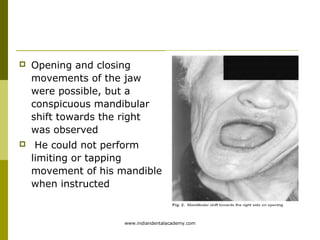 complete denture treatments for a cerebral palsy patient/ dentistry ...