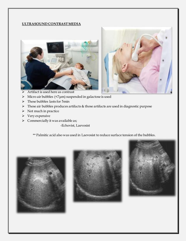 Adverse reactions and management of contrast reactions