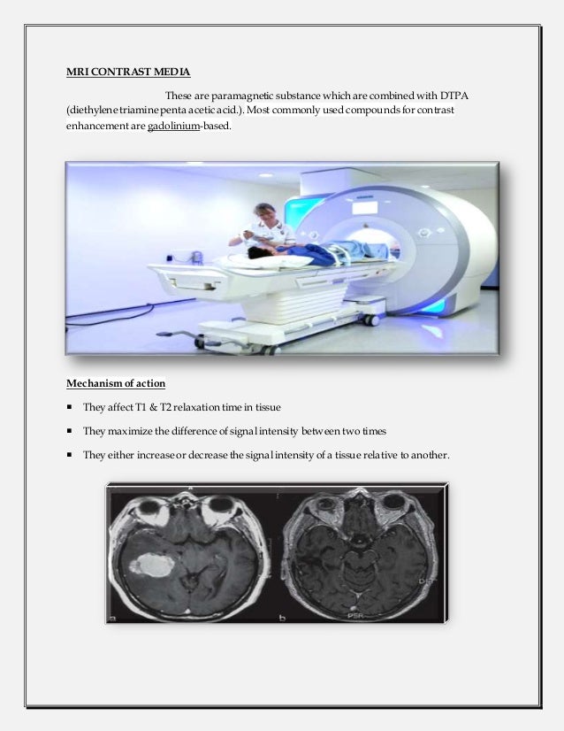 Adverse reactions and management of contrast reactions