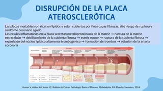 INFARTO AGUDO DEL MIOCARDIO | PPTX