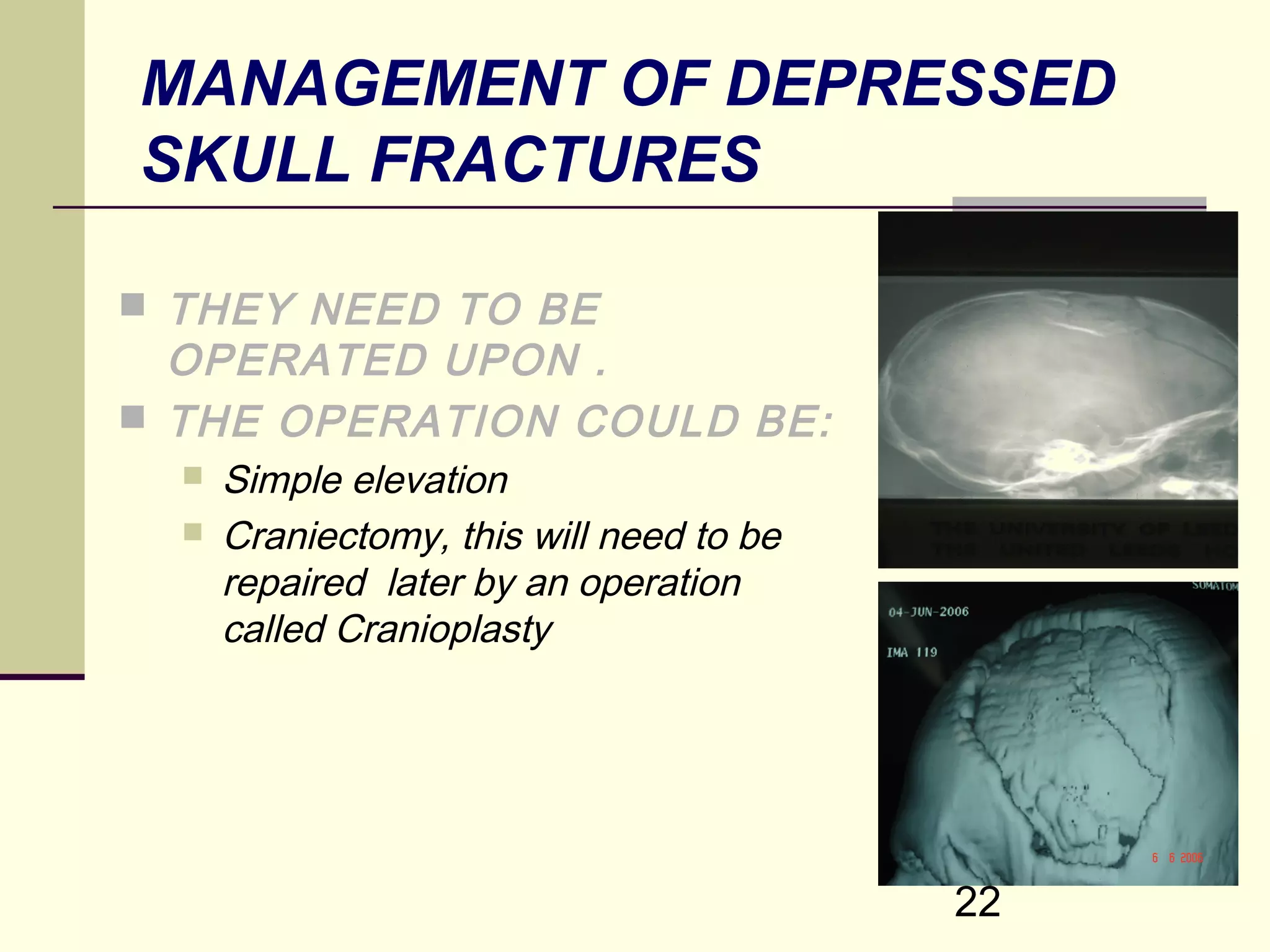 CRANIO CEREBRAL INJURIES FOR MEDICAL STUDENTS | PPT