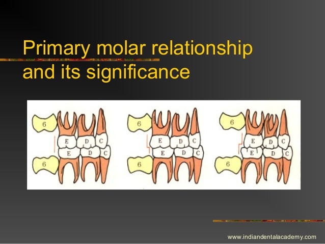 Development of occlusion /certified fixed orthodontic courses by Indi…