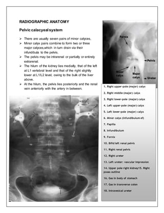 IVU- Intravenous urography | DOCX