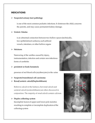 IVU- Intravenous urography | DOCX