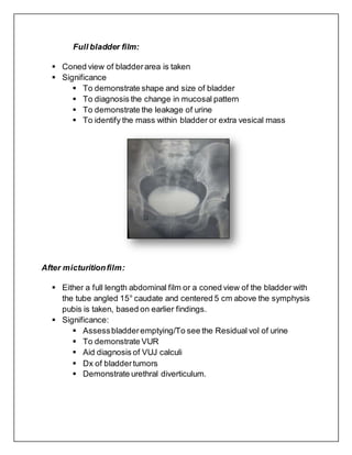 IVU- Intravenous urography | DOCX