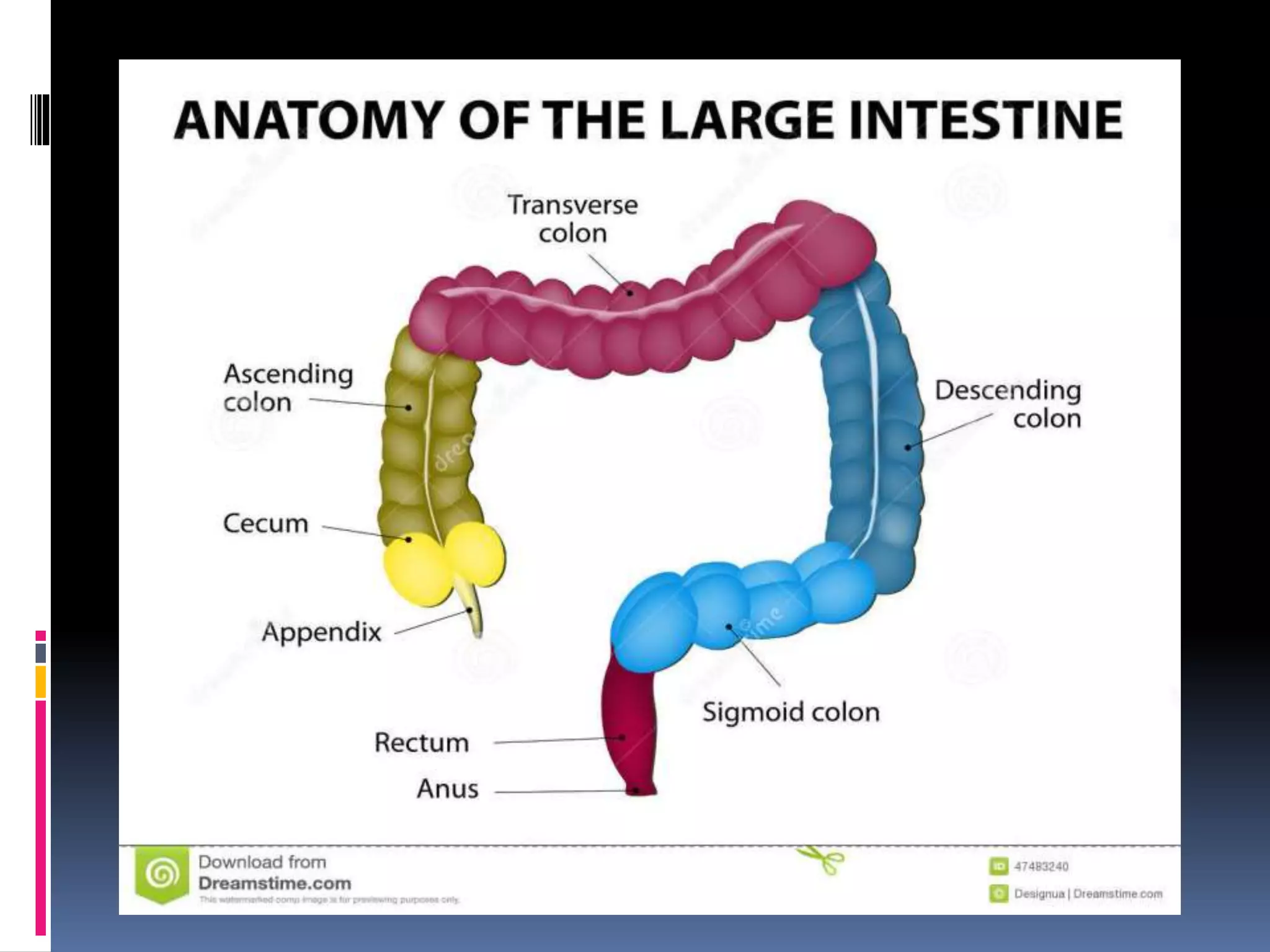 Large intestinal tumors | PPTX