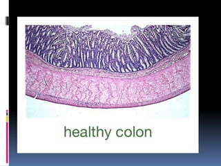 Colon Slide