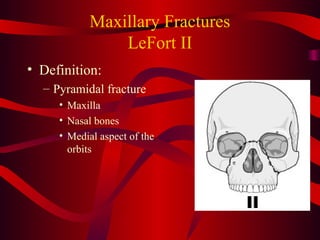 Copy of maxillary fracture and mid face.ppt