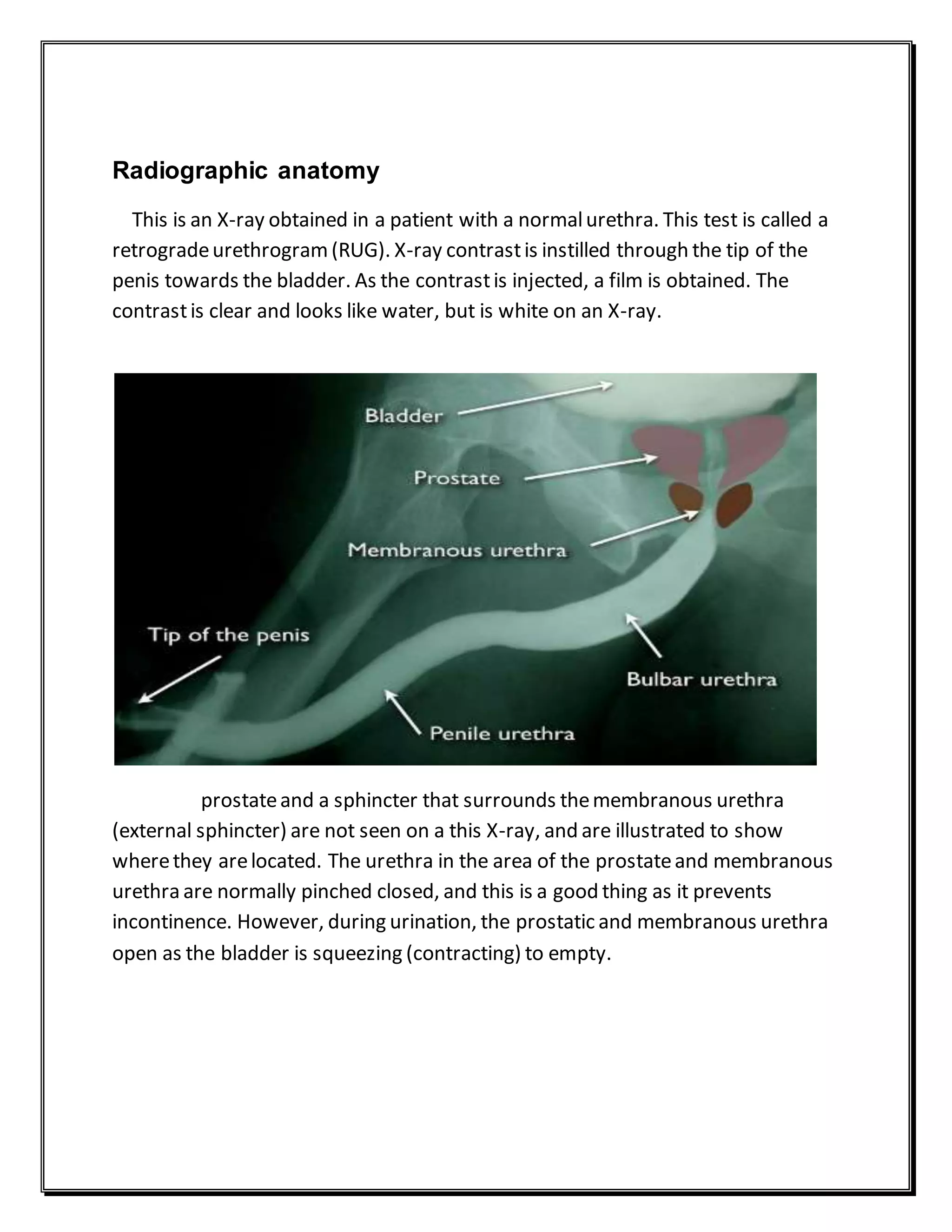 MICTURATING CYSTOURETHROGRPHY AND RETROGRATE UROGRAPHY - MCU/ RGU | DOCX