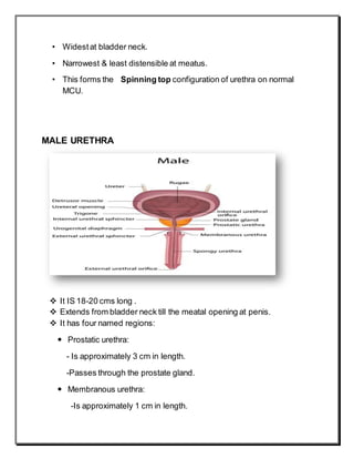 MICTURATING CYSTOURETHROGRPHY AND RETROGRATE UROGRAPHY - MCU/ RGU | DOCX
