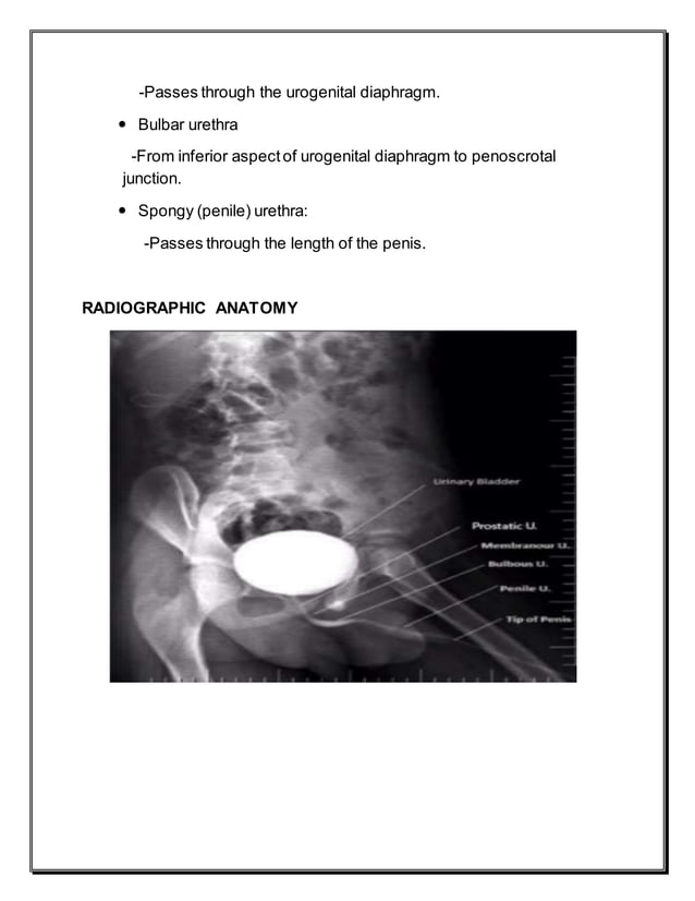 MICTURATING CYSTOURETHROGRPHY AND RETROGRATE UROGRAPHY - MCU/ RGU | DOCX