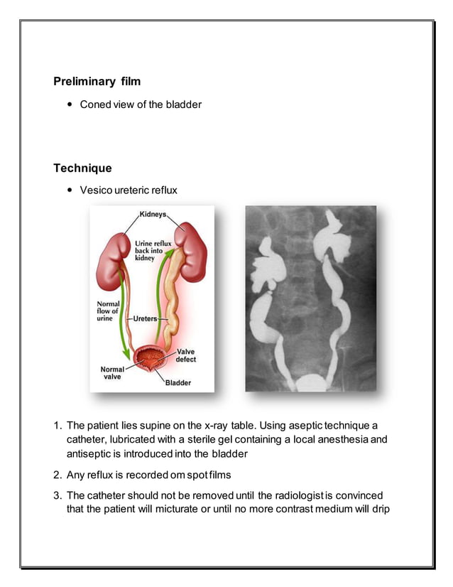 MICTURATING CYSTOURETHROGRPHY AND RETROGRATE UROGRAPHY - MCU/ RGU | DOCX