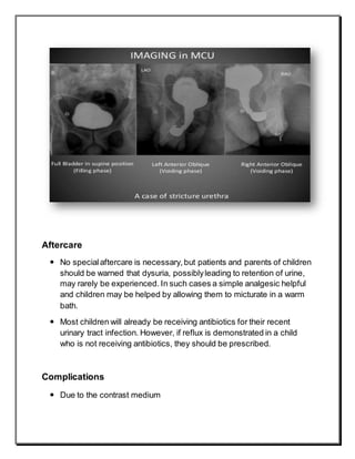 MICTURATING CYSTOURETHROGRPHY AND RETROGRATE UROGRAPHY - MCU/ RGU | DOCX