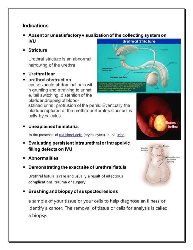 MICTURATING CYSTOURETHROGRPHY AND RETROGRATE UROGRAPHY - MCU/ RGU | DOCX