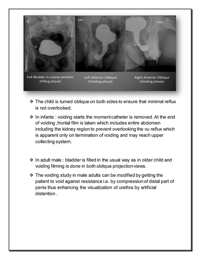 MICTURATING CYSTOURETHROGRPHY AND RETROGRATE UROGRAPHY - MCU/ RGU | DOCX