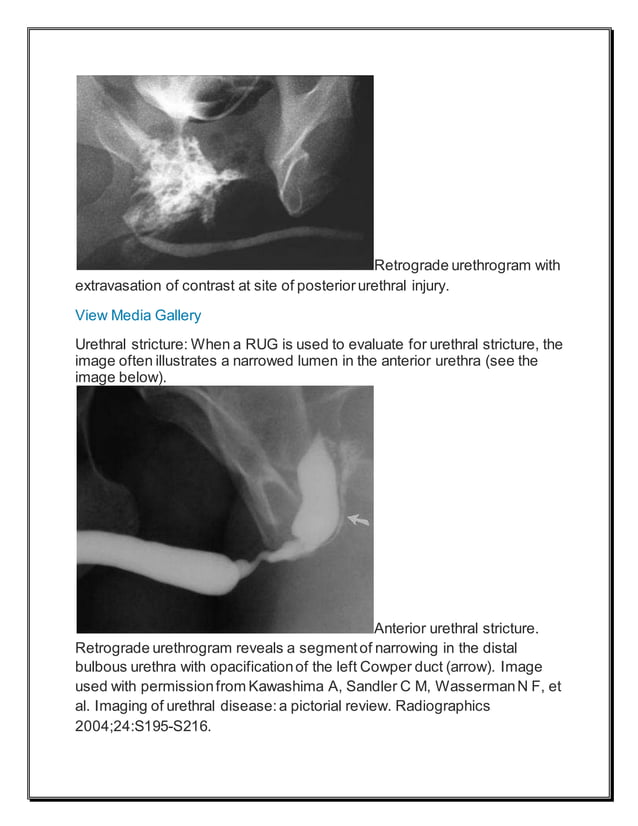 MICTURATING CYSTOURETHROGRPHY AND RETROGRATE UROGRAPHY - MCU/ RGU | DOCX
