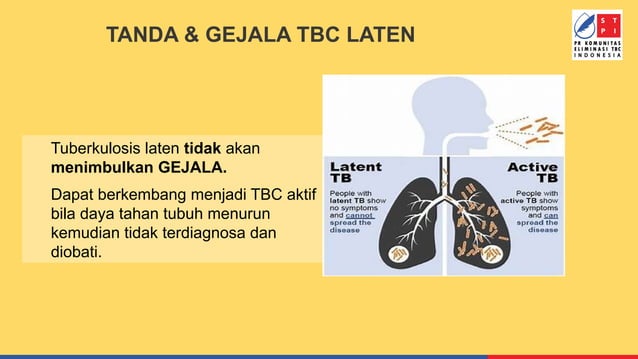 Copy of MPI INFORMASI DASAR TUBERCULOSIS.pptx