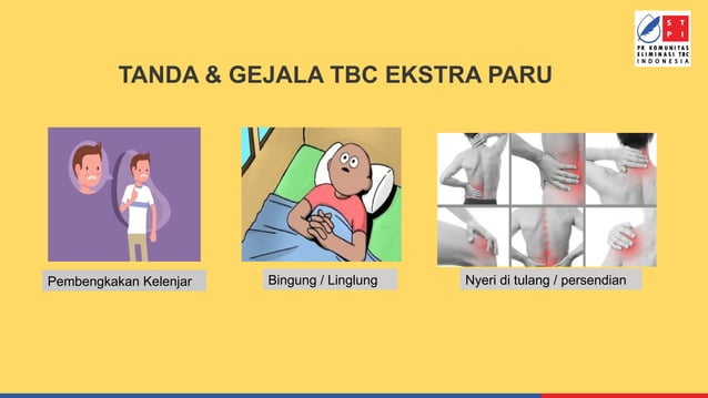 Copy of MPI INFORMASI DASAR TUBERCULOSIS.pptx