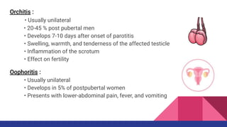 Mumps.ppt Community Medicine | PDF