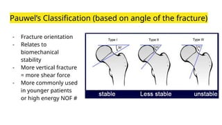 Neck of Femur Fractures in malaysia.pptx | Bone and Joint Conditions ...