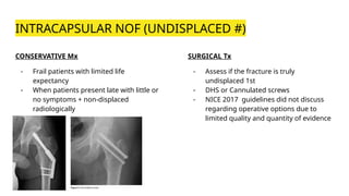Neck of Femur Fractures in malaysia.pptx | Bone and Joint Conditions ...