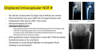 Neck of Femur Fractures in malaysia.pptx | Bone and Joint Conditions ...