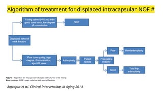 Neck of Femur Fractures in malaysia.pptx | Bone and Joint Conditions ...