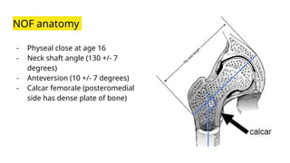 Neck of Femur Fractures in malaysia.pptx