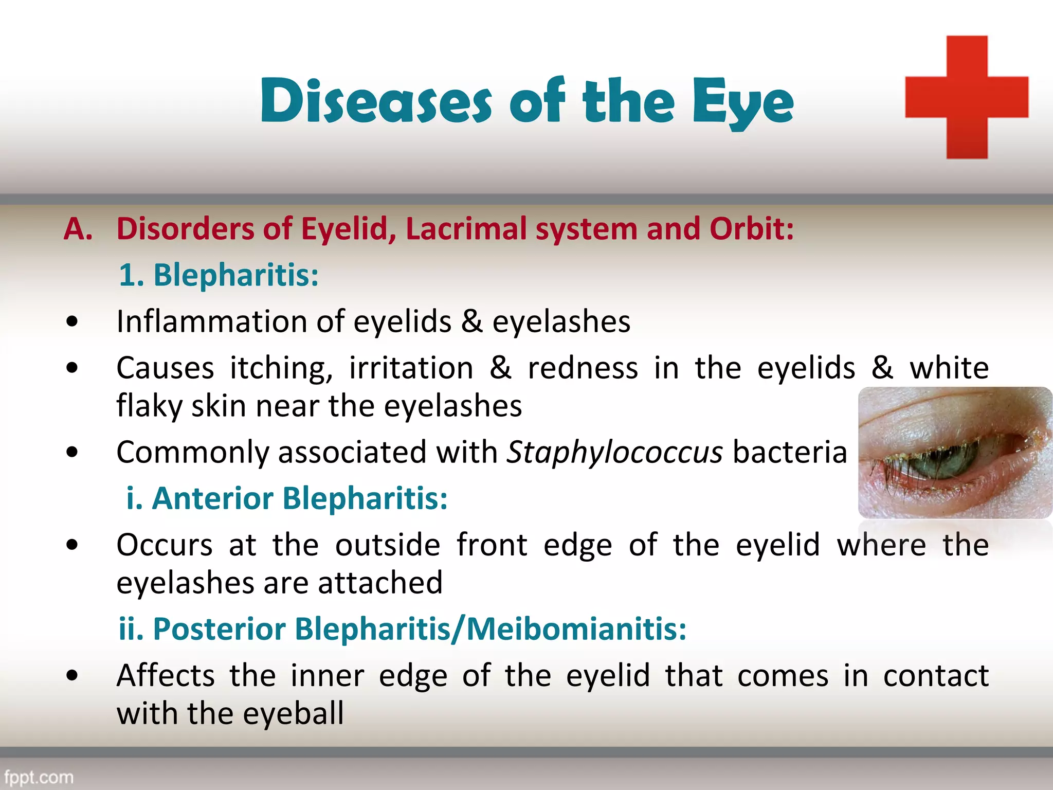 Ophthalmology | PDF