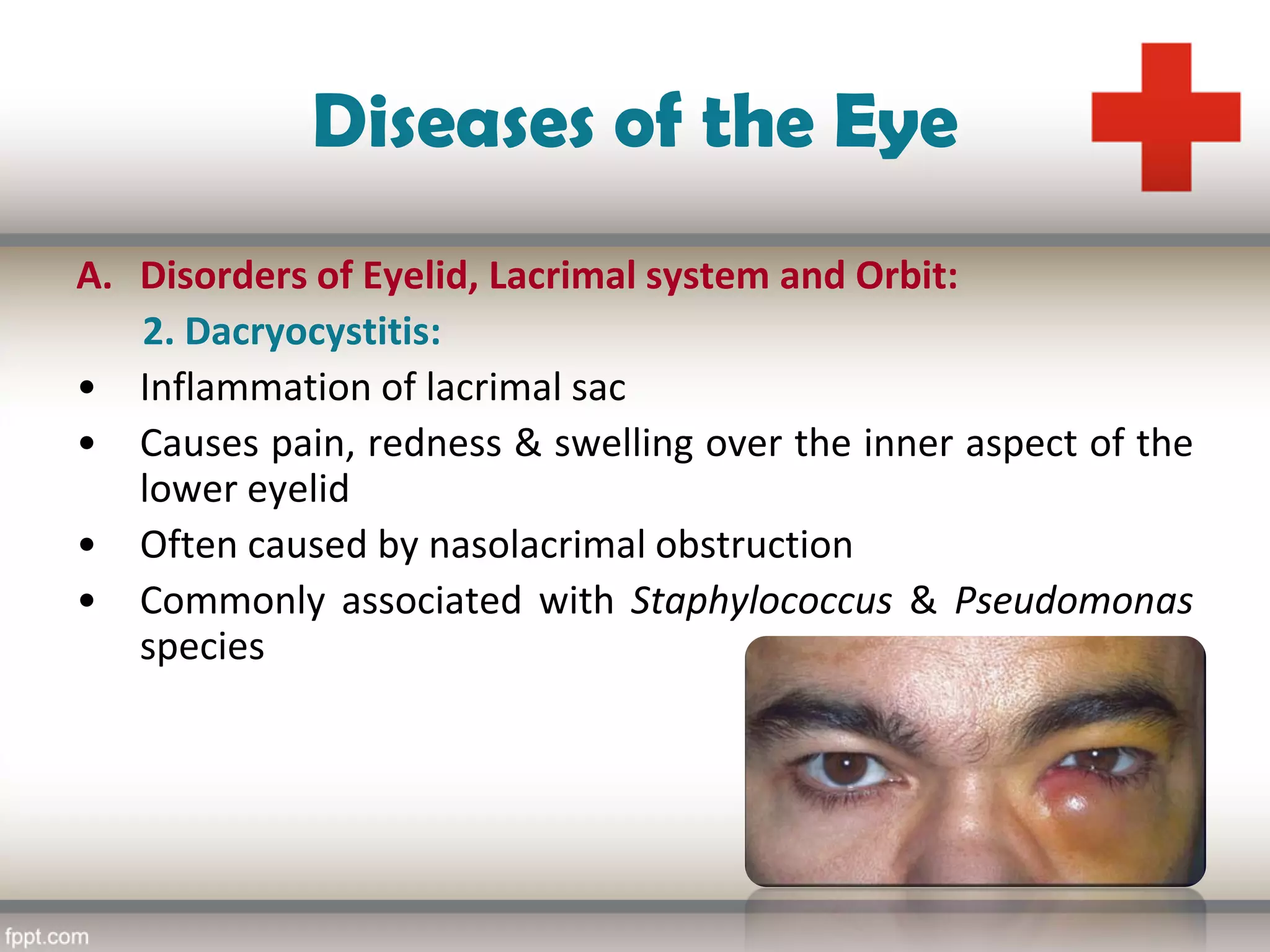 Ophthalmology | PDF