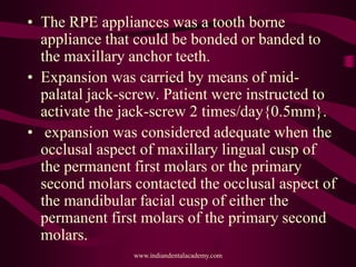 palatal expanson in orthodontics /certified fixed orthodontic courses ...