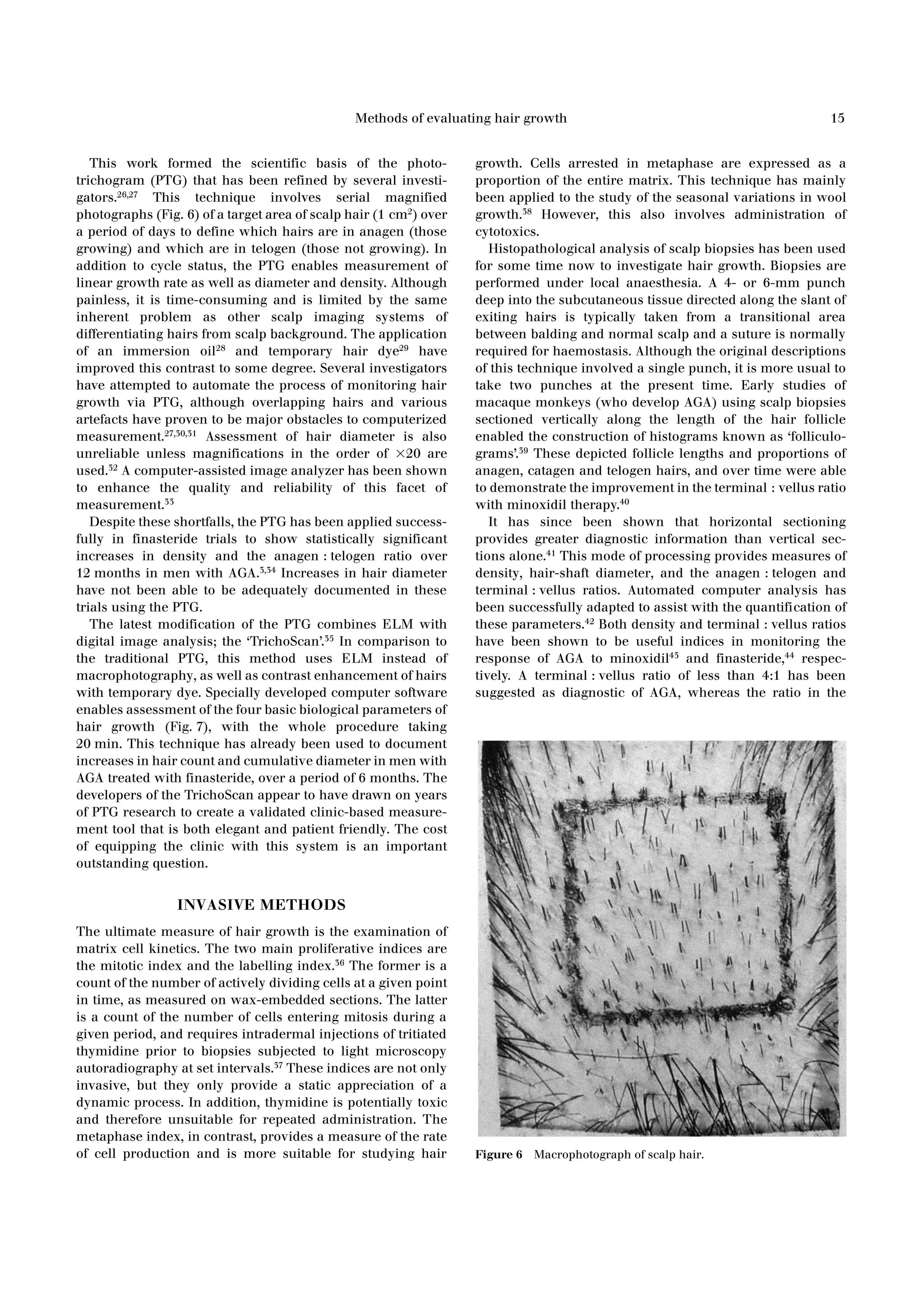 Methods of evaluating hair growth | PDF