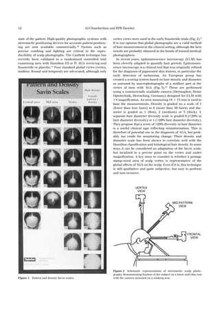 Methods of evaluating hair growth | PDF