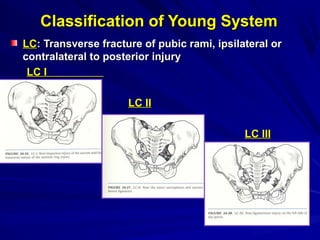 Copy of pelvic_fractures_o6th_u_presentation by dr. mahmoud Abdel ...