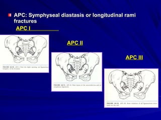 Copy of pelvic_fractures_o6th_u_presentation by dr. mahmoud Abdel ...