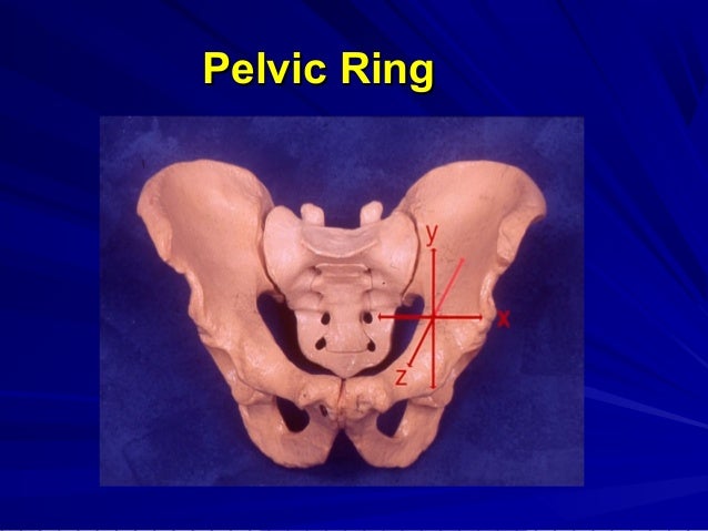 Copy of pelvic_fractures_o6th_u_presentation by dr. mahmoud Abdel Kar…