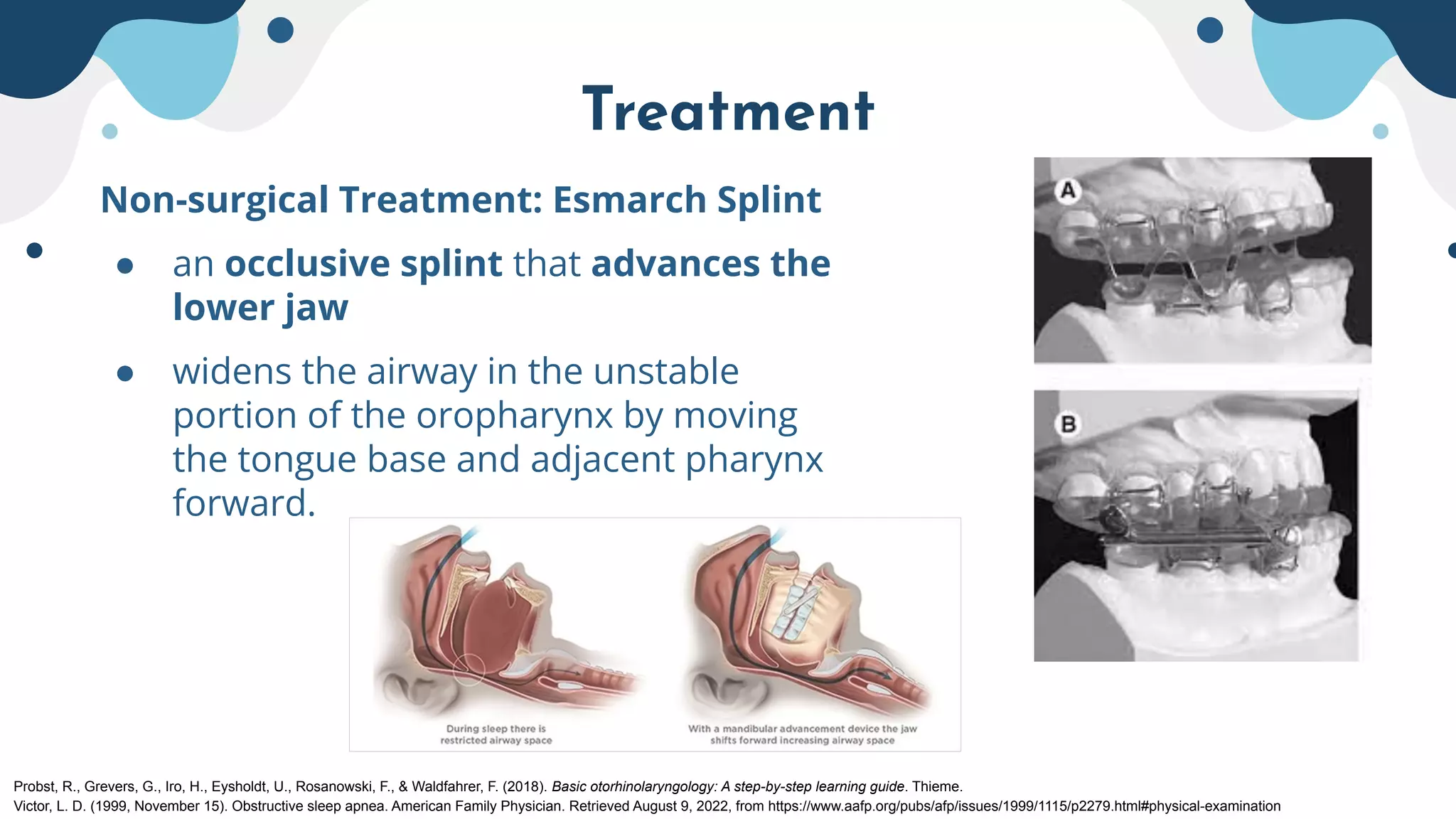 Copy of Peripheral Obstructive Sleep Apnea Syndrome (OSAS) - Gonzales.pdf