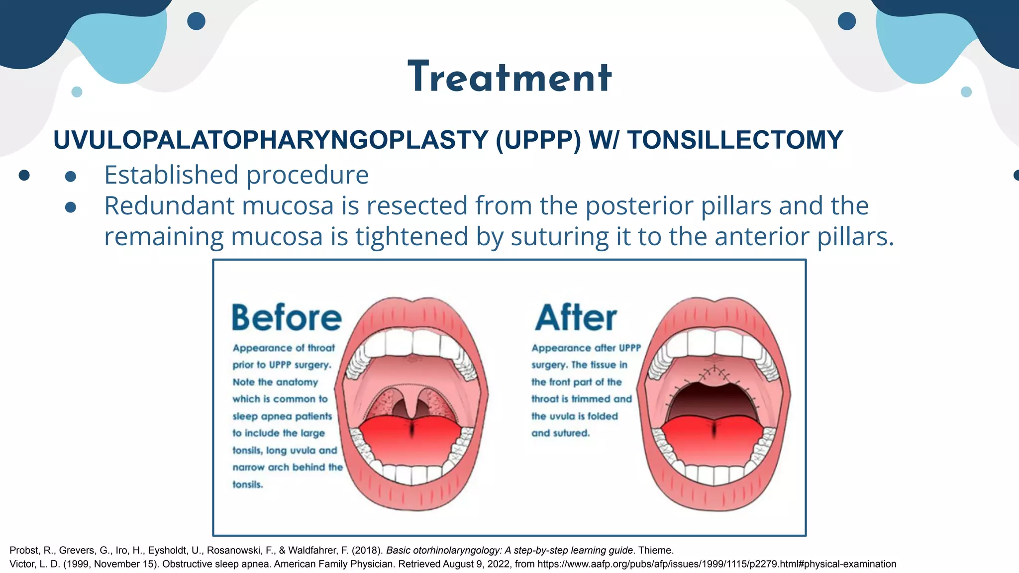 Copy of Peripheral Obstructive Sleep Apnea Syndrome (OSAS) - Gonzales.pdf