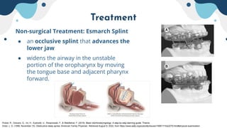 Copy of Peripheral Obstructive Sleep Apnea Syndrome (OSAS) - Gonzales.pdf