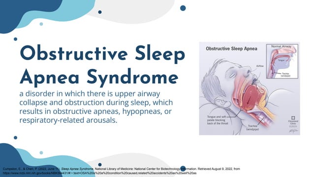 Copy of Peripheral Obstructive Sleep Apnea Syndrome (OSAS) - Gonzales.pdf