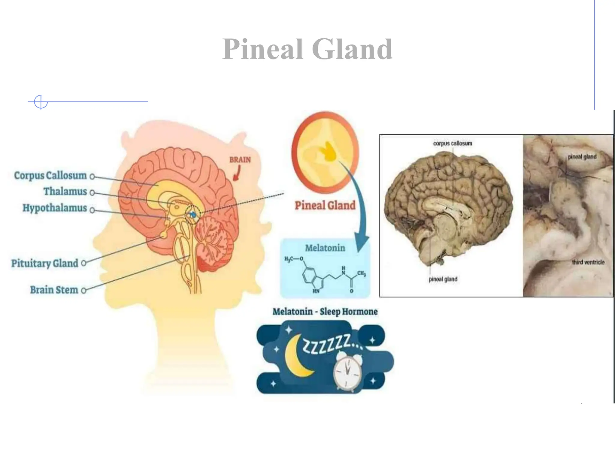 pineal gland and thalamus ppt from sensory chapter of anatomy | PPTX