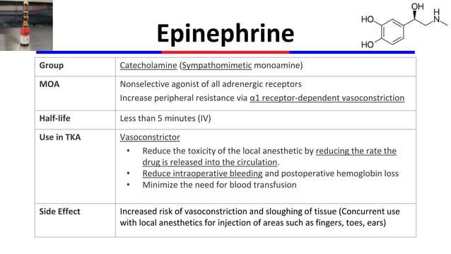 Knee Arthroplasty Intra-Articular Injection cocktail | PPTX ...