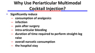 Knee Arthroplasty Intra-Articular Injection cocktail | PPTX